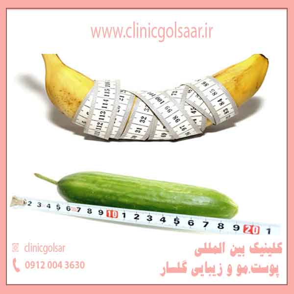 ده روش بزرگ کردن آلت تناسلی کلینیک تخصصی پوست و مو زیبایی گلسار رشت